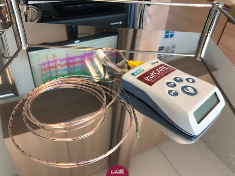 24 Hour Oesophageal ph/Impedance Study | GUTCARE